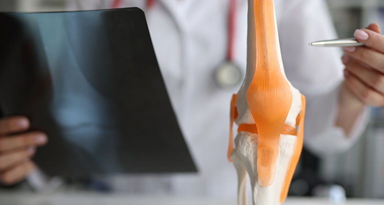 Reumatologia | Grupo HPA Saúde